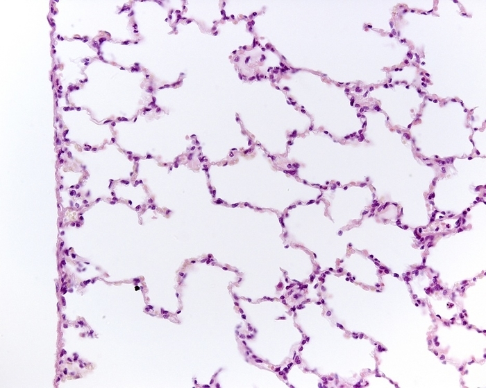 Lung Histology Alveoli
