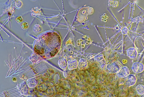 Anabaena Under Microscope Biology